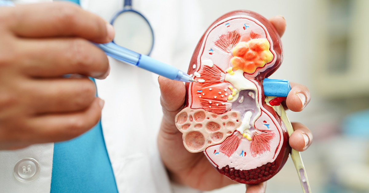 Kindred Hospital Houston Medical Center expands renal care services by ...